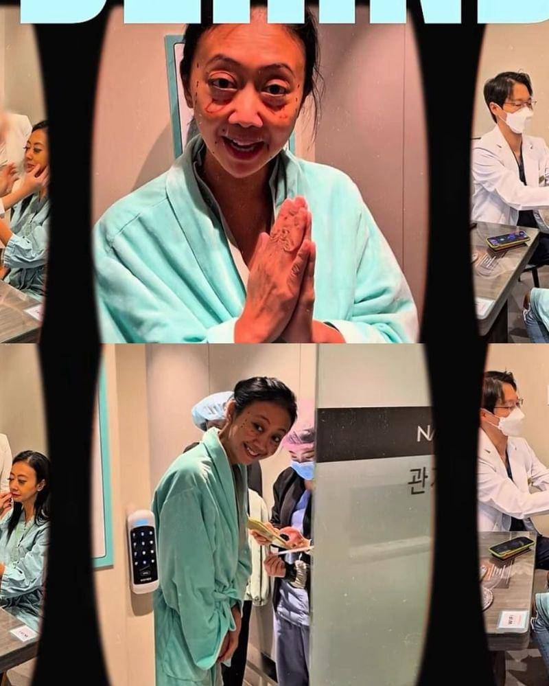 7 Foto Asri Welas Setelah Oplas di Korea Selatan, Pangling! | Popmama.com